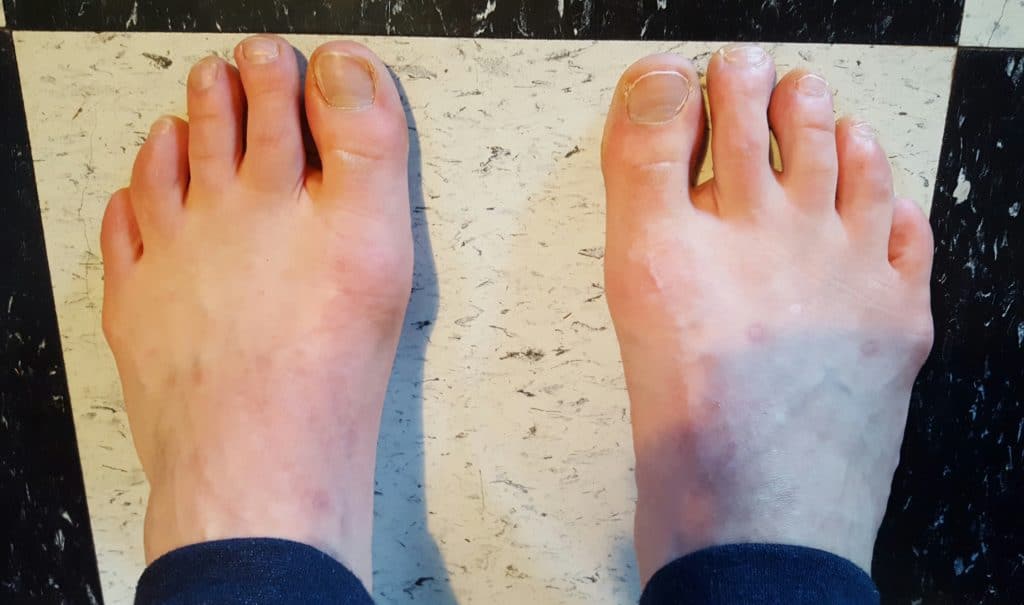 Plantar flexion and the Low Sit – POST COMPETITIVE INSIGHT